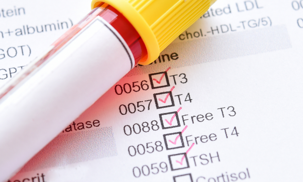 What you need to know about your Thyroid Labs
